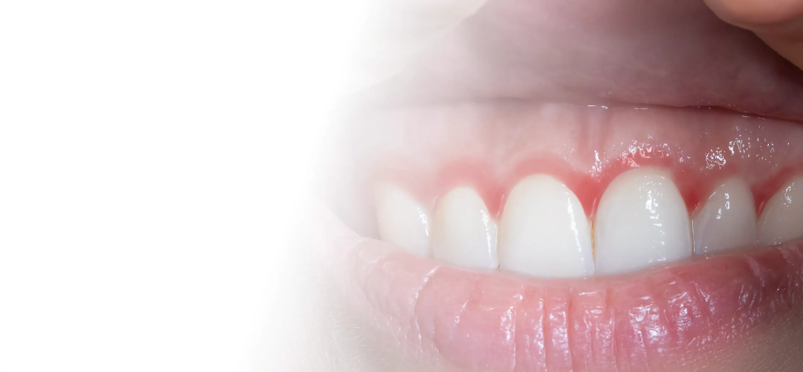 Parodontologie - DHUC Zahnärzte in Hannover